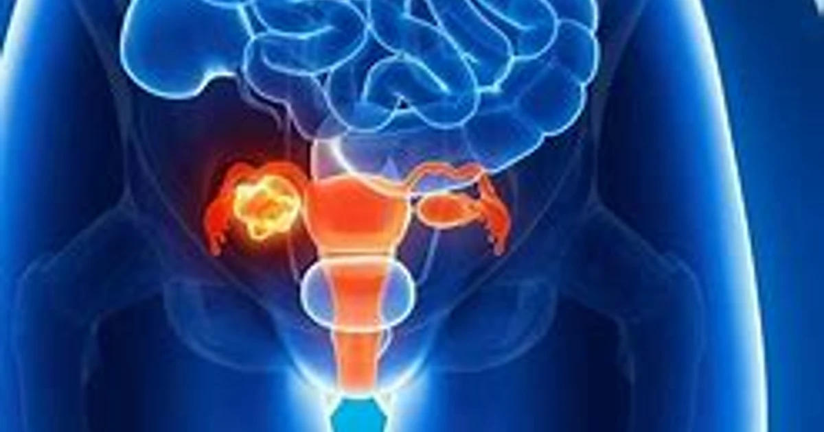 Fitness Blue Waffles